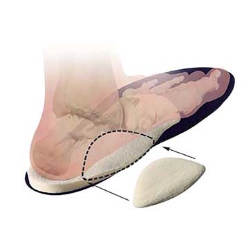 Scaphoid Pads | Hapad